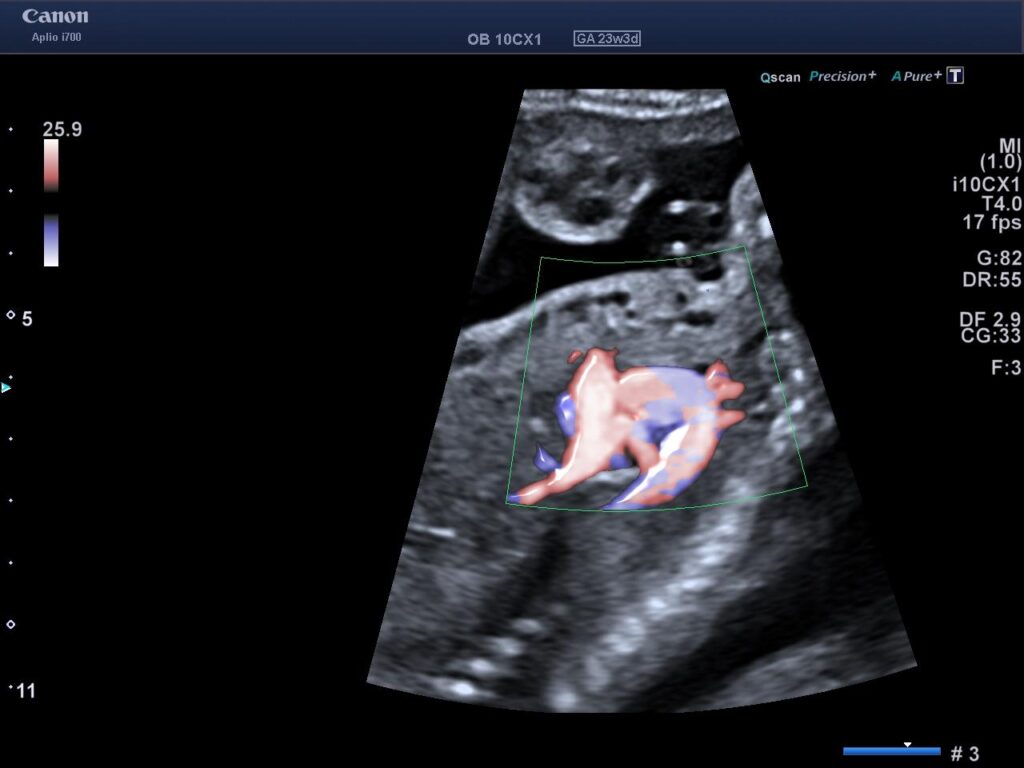 Fetal / Pediatric Echocardiography - X-Clinic - Lisboa